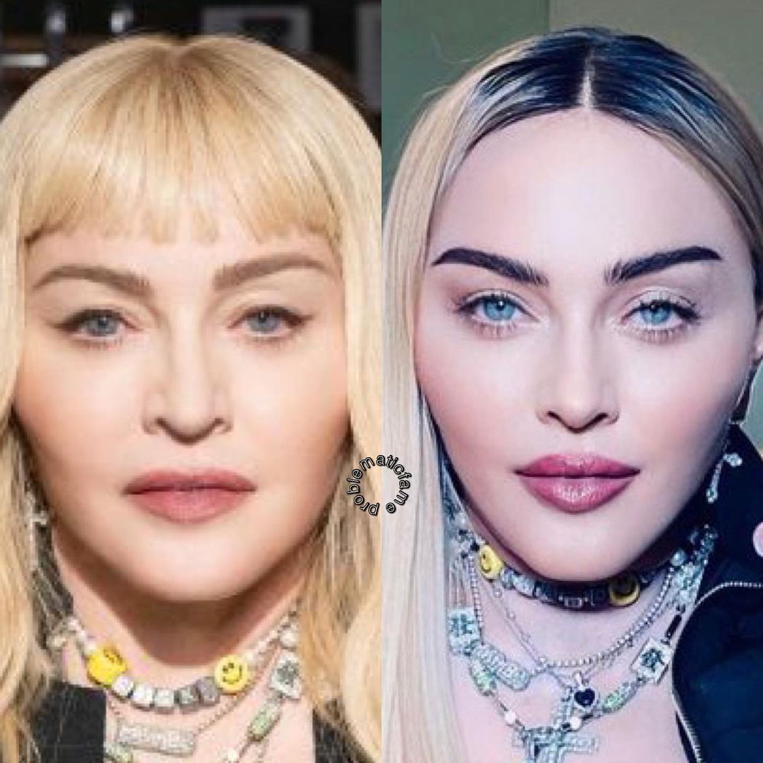 Madonna, de 63 anos, choca fãs ao usar filtros de fotos e 'parece ter ...