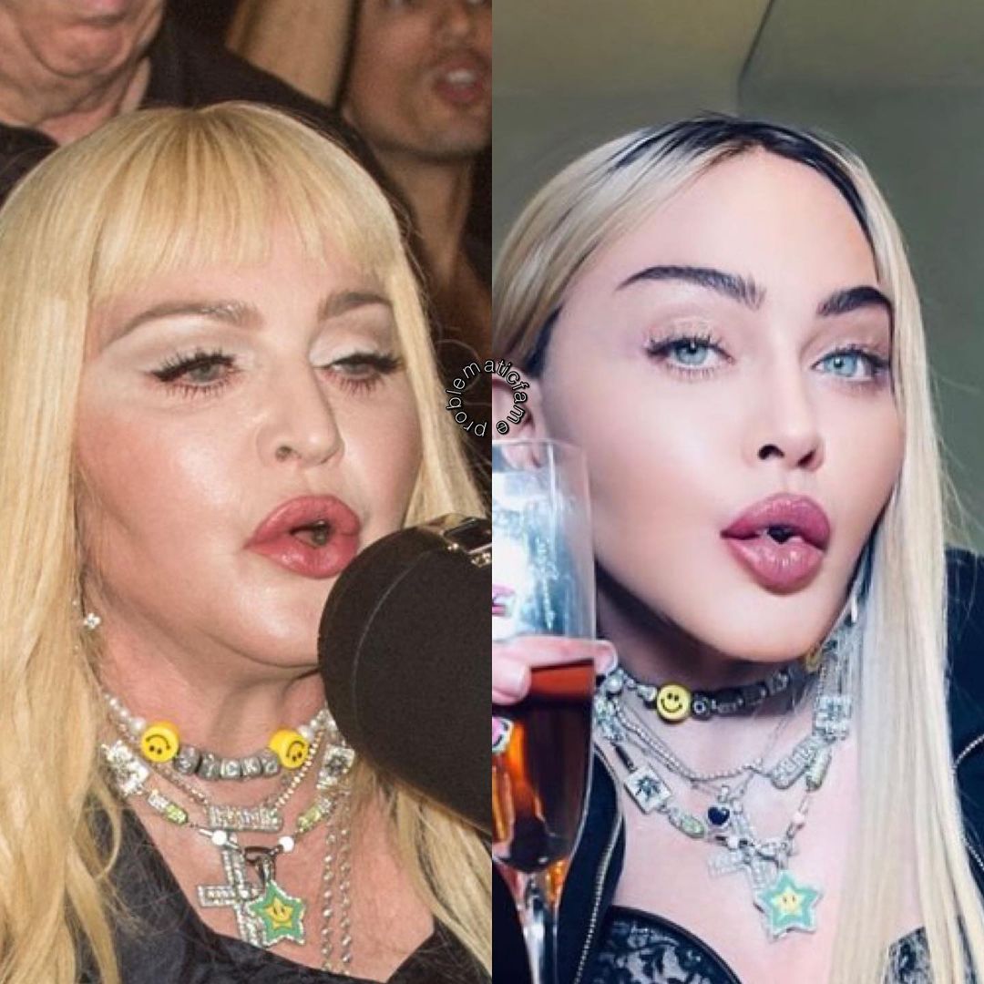 Madonna, de 63 anos, choca fãs ao usar filtros de fotos e 'parece ter ...